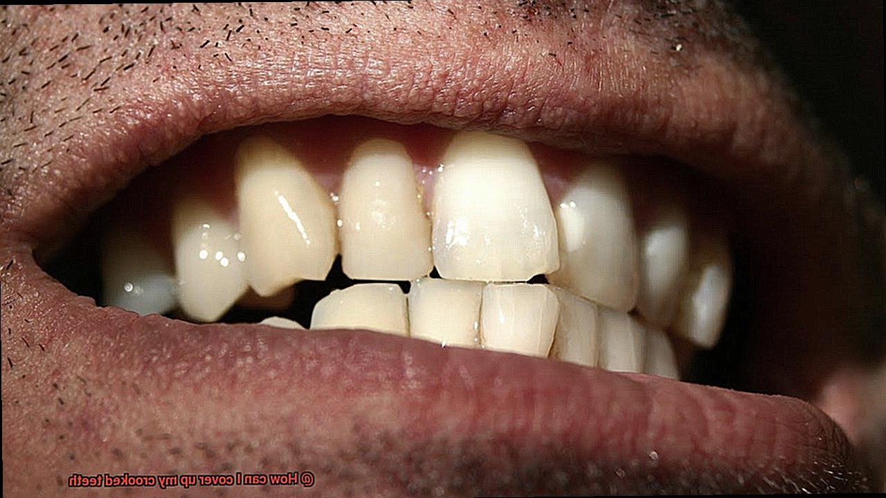 How can I cover up my crooked teeth? - Pastime Bar And Grill